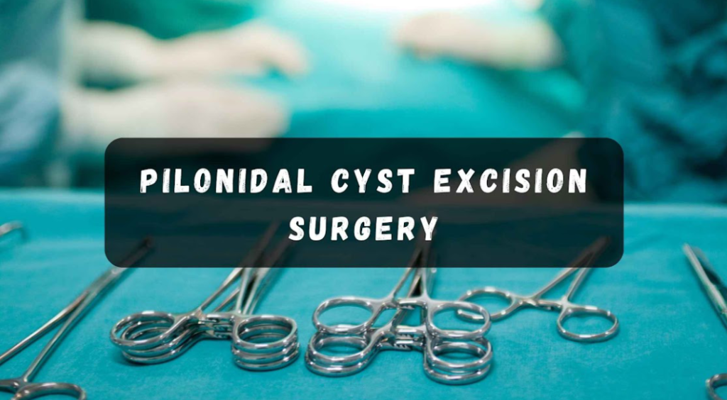Complications of Pilonidal Cyst Excision Surgery: What You Need to Know ...